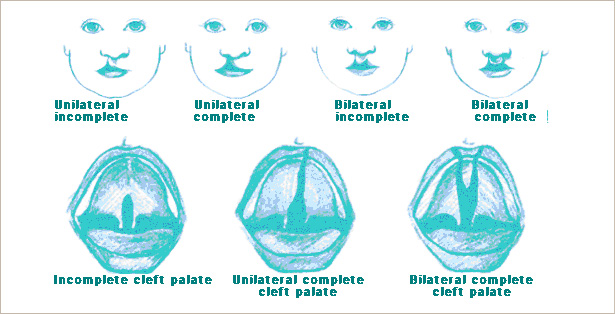 Our Services | Introduction | Plastic Surgery | Asan Medical Center
